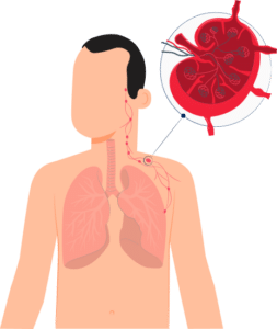 VA Disability Rating for Hemic and Lymphatic Conditions | Veterans Guide